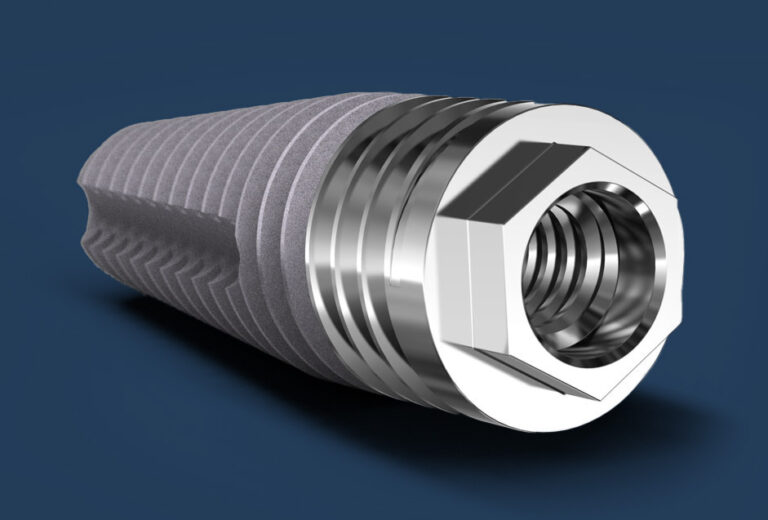 Implante Dental MSc - Southern Implants Ibérica