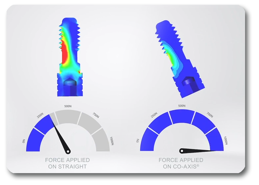 Implante Co-Axis® - Southern Implants Ibérica